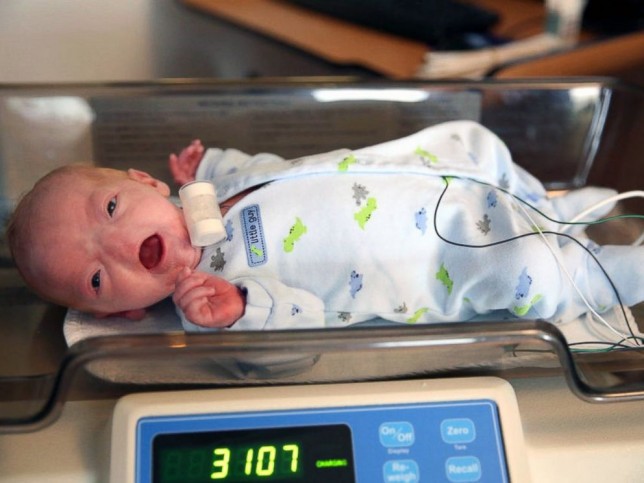 Meet Miracle Baby Born Without Nose And Breaths Perfectly (PHOTOS ...